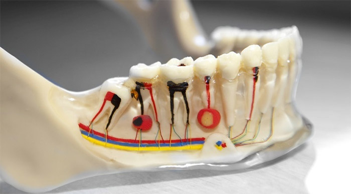 Endodontic Treatment in Bahrain | Saudi Arabia