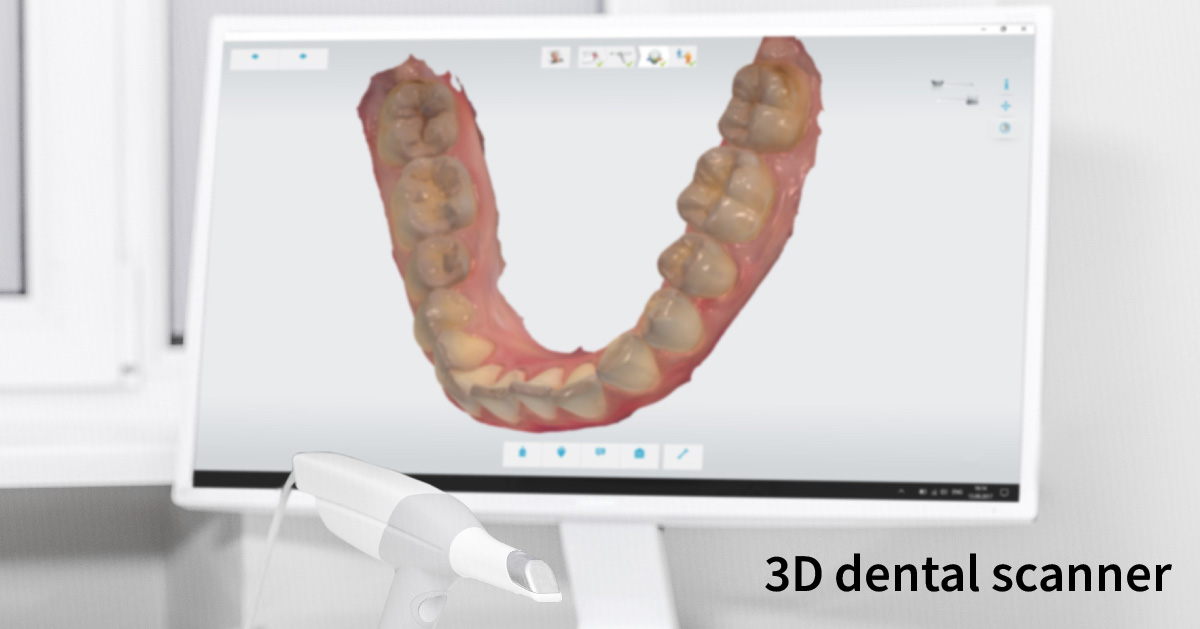Digital dentistry in Saudi Arabia | 3D | Digital dental scanning